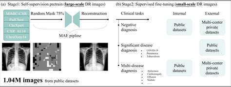 [논문 리뷰] A Foundation Model For Generalizable Disease Diagnosis In Chest X Ray Images