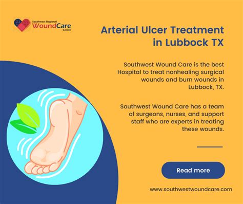 Arterial Ulcers Symptoms And Treatment In Lubbock Tx