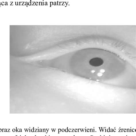 Corneal Reflection And Bright Pupil As Seen In The Infrared Camera Image Download Scientific