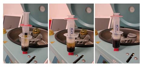 Prp Prep דר איתמר בוצר