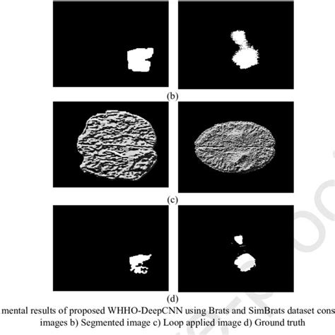 Statistical Analysis Using Brats Dataset Download Scientific Diagram