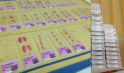 2d Barcodes On Slides And Cassettes In The Laboratory Routine For