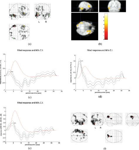 Case No 8 A Spm F Of Fourier Basis Set Regressors Overlaid Onto