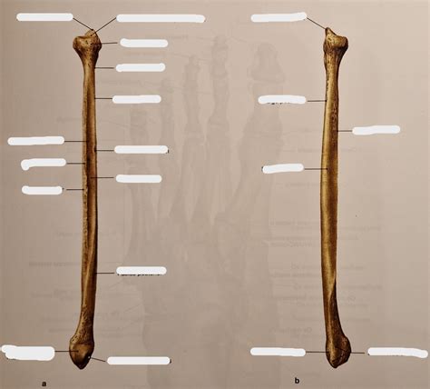Fibula Diagram Quizlet