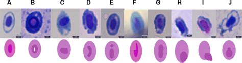 Nuclear Erythrocyte Anomalies Enas Analyzed Including A Normal