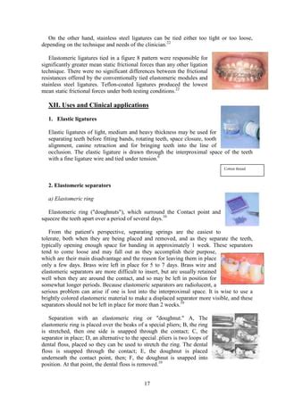 Elastics In Orthodontics Pdf