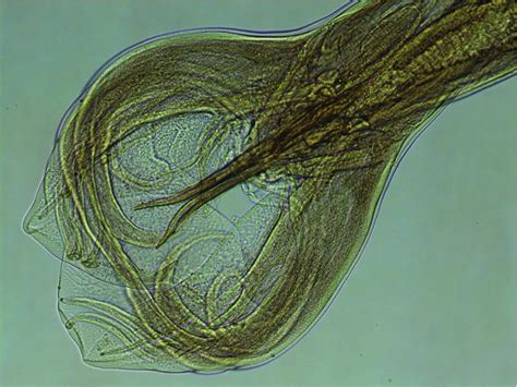 Nematoda ‘roundworms Part 1 Concepts And Bursate Nematodes