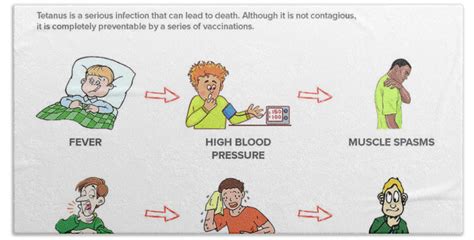 Tetanus Symptoms Beach Sheet For Sale By Findatopdoc
