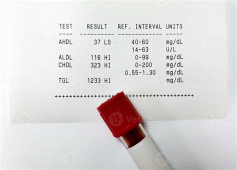 Blood Sample Isolated For Lipid Profile Test With Abnormal Report Stock Photo At Vecteezy