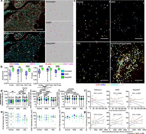 Manual Differential Lymphocytes High At John Hipple Blog