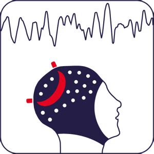 How To Decide Which Eeg Electrode Technology Best Fits Your Research