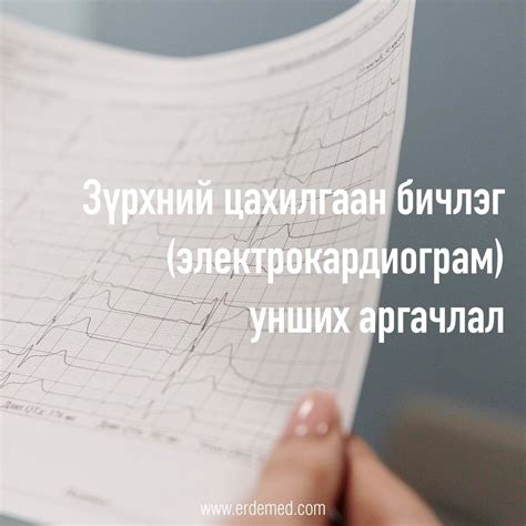 Erdemed Хэвийн зүрхний цахилгаан бичлэг нь зүрхний цикл тус бүрийн