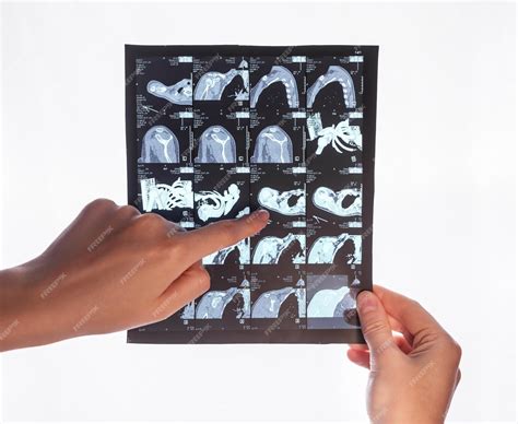 Premium Photo Ct Hand Pointing To Computerized Tomography Scan Image Doctor Showing Medical