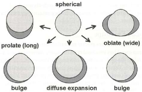 Figure 1 From Ocular Shape And Myopia Semantic Scholar