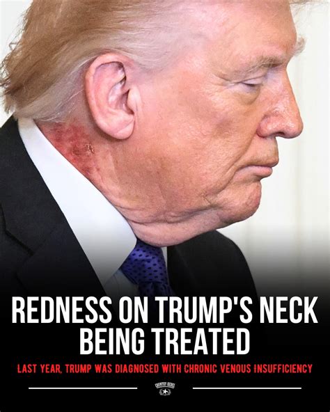 Country Rebel Last Year President Trump Was Diagnosed Facebook