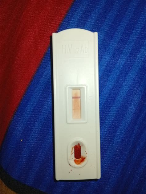 Tes Hiv Hellosehat