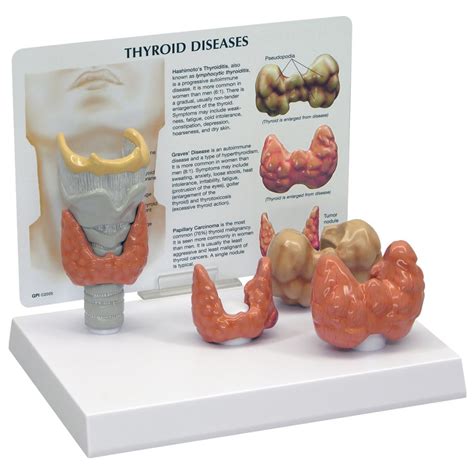 Thyroid Model Sem Trainers