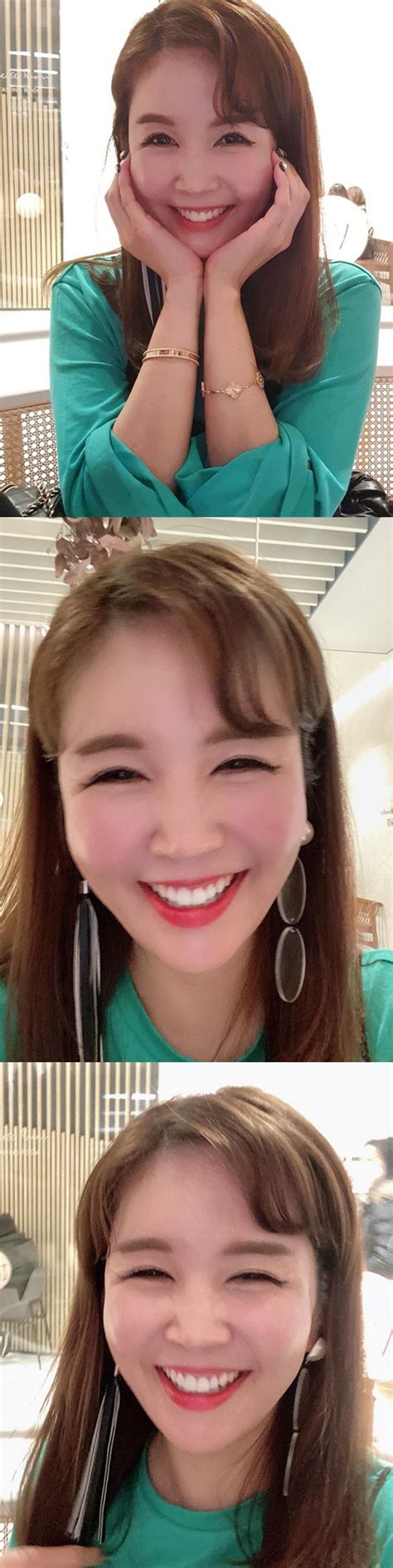 그 얼굴이 진짜 내 얼굴인 줄장영란 성형수술 해명 이어 보정 어플 고백 Sns는 지금