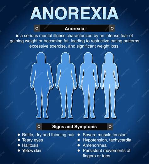Free Vector Informative Poster Of Anorexia Eating Disorder