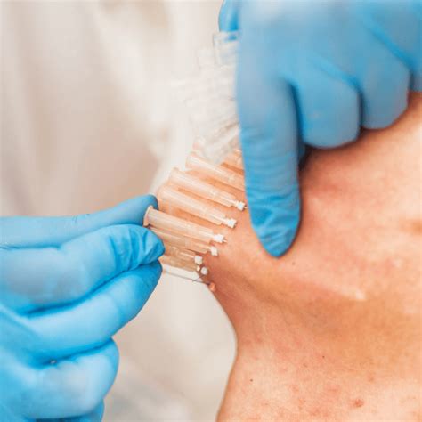 Diaminy Pdo Screw Threads Bag Of 50