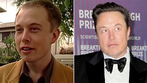 Elon Musk Hair Transplant 5 Clues To His Full Mane In 2026