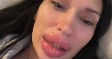 Lip Filler Bimbo Defends Big Fake Lips After Being Mocked By Trolls