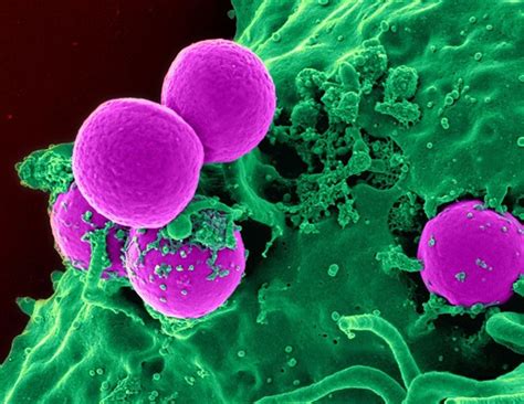 Exosome Mediated Sirna Delivery Targets Antibiotic Resistance In Bacteria