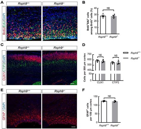 Rsph9 − − Mice Develop Normally In Embryonic Cortex Development A
