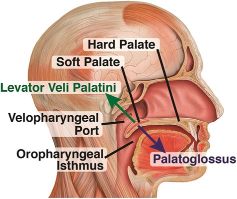 Tensor Veli Palatini Dissection