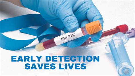 Early Detection Programme For Prostate Cancer Urgently Needed To Save Lives