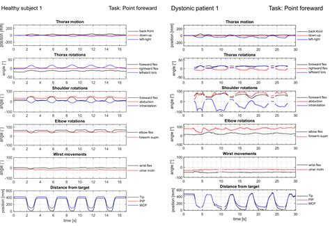 Protocol For Upper Limb Kinematic Analysis In Paediatric Movement Disorders And Relative