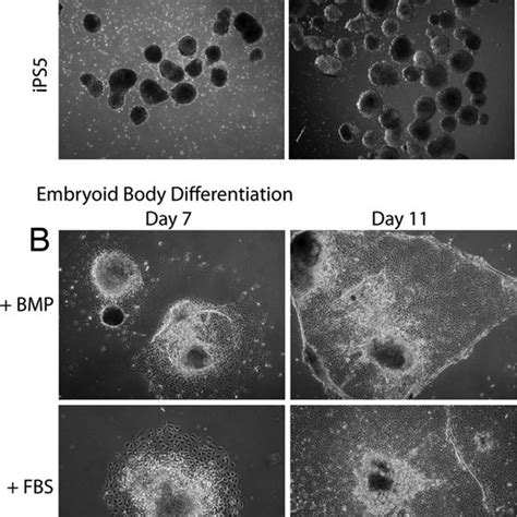 Pluripotency Of Ips Cells And Up Regulation Of Ectodermal Endodermal