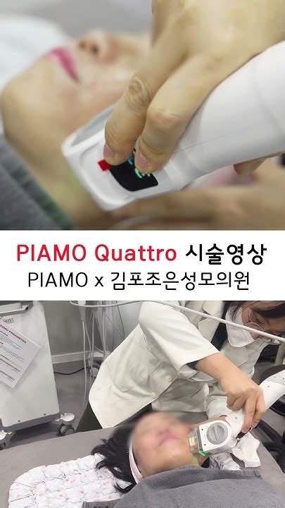 리프팅시술고민중이세요 피아모콰트로 리프팅 보고 가세요~ 리프팅시술 Skincare 리프팅 리프팅효과 Youtube