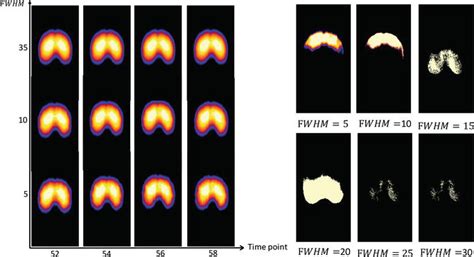 Spatiotemporal Statistical Shape Model Construction For The Observation Of Temporal Change In