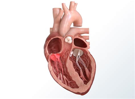 Triclip Device May Be Safe And Effective At Reducing Tricuspid