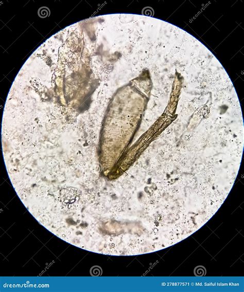 Bee Leg Under Microscope Stock Image Image Of Insect 278877571