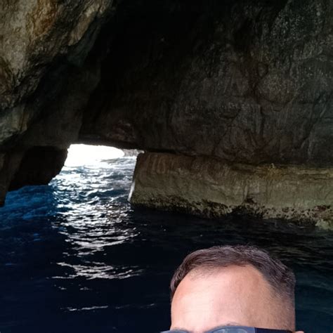 Amir SpahiĆ Head Of Department Pathology Research Profile