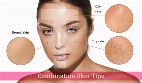 Normal Skin Characteristics