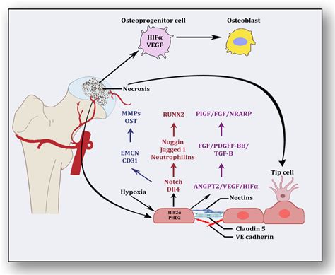 Angiogenesis Coagulopathy And Endothelial Dysfunction In Anfh Encyclopedia Mdpi