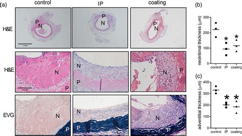 Inhibition Of Pd‐1 Decreases Neointimal Thickness After Patch