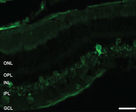 Expression Pattern Of All Amacrine Cells In The Control And