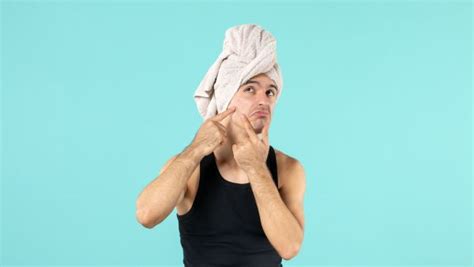 Guide To Post Pimple Popping Care And Scar Prevention Boldsky Com