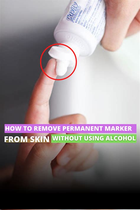 Ways To Remove Permanent Marker From The Skin Wikihow Artofit