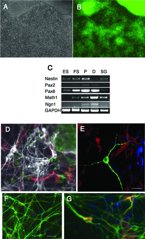Attachment And Differentiation Of Neural Progenitors Neural