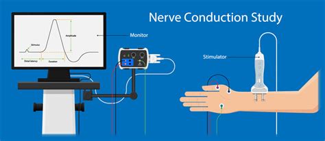Emg Vancouver Dr Craig Best Dr Craig Best