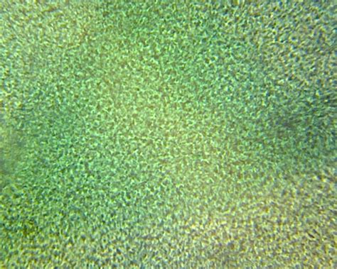 Ulva Sea Lettuce Thallus Whole Mount