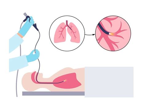 Bronchoscopy Test In Hyderabad Sai Siddhartha Hospital