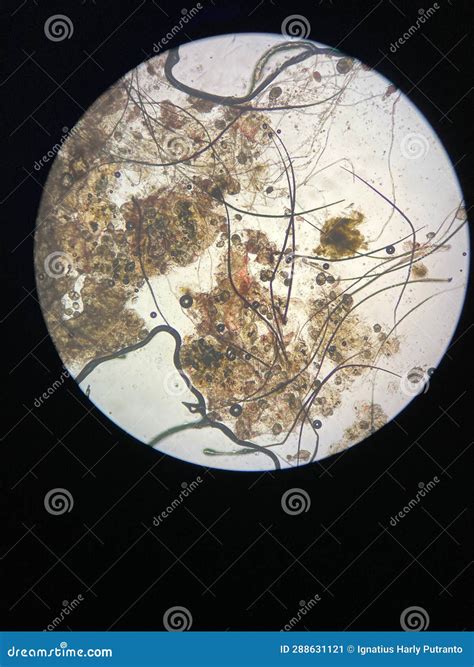 Notoedres Cati Under The Microscope Notoedric Mange Also Referred To