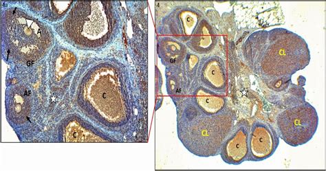 Ihc Staining With Pten Primary Antibody Of Ovarian Tissues In The Pcos