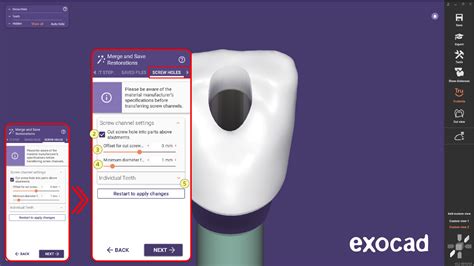 Merge And Save Restorations Exocad